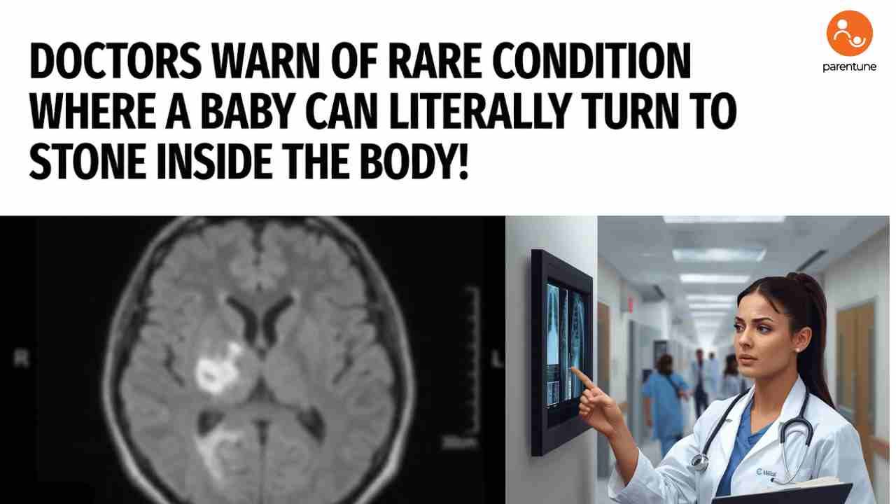 Doctors Warn of Rare Condition Where a Baby Can Literally Turn to Stone ...