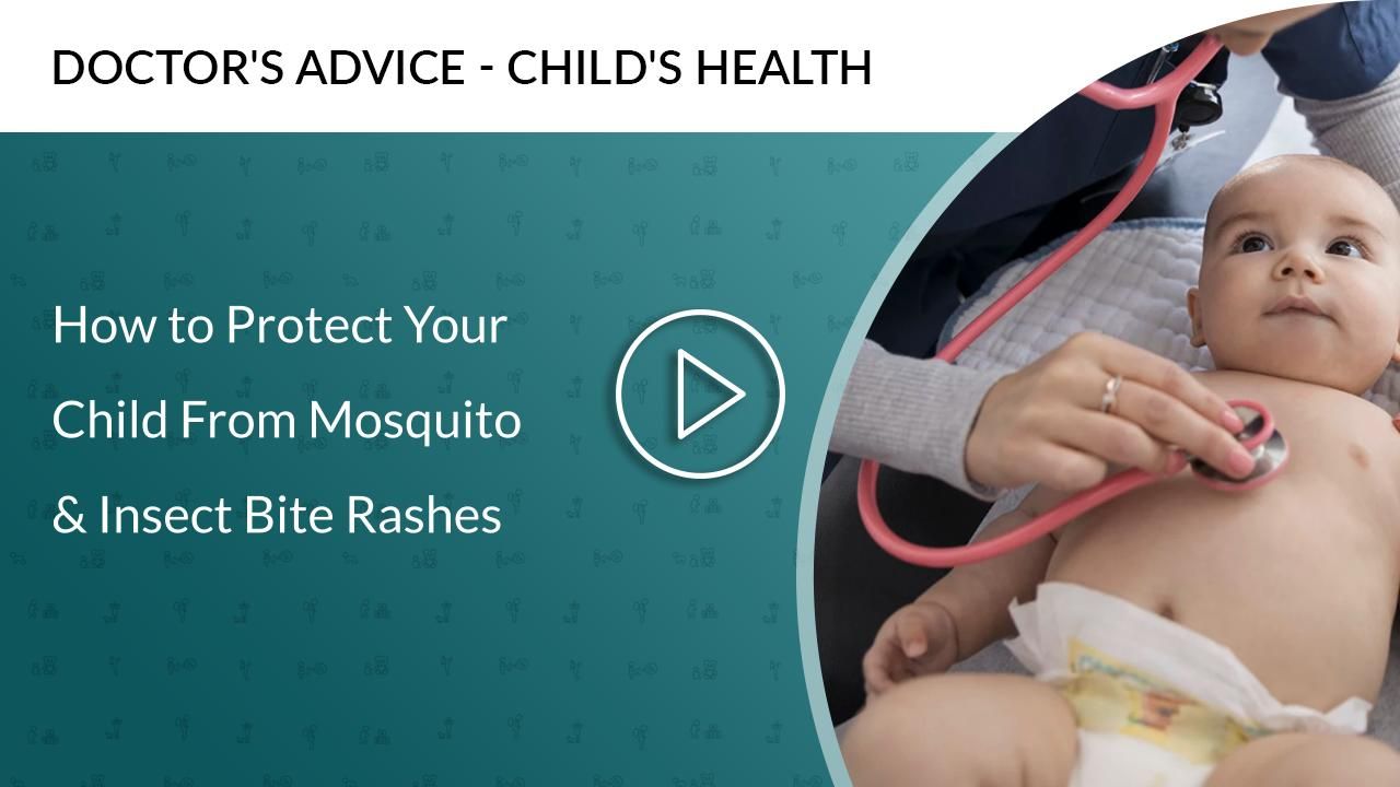 How To Protect Your Child From Mosquito & Insect Bite Rashes ...