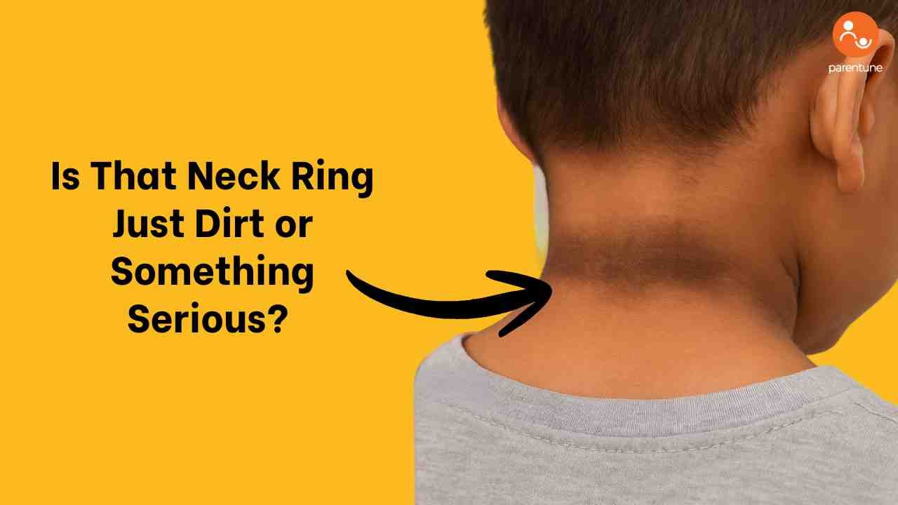 Is That Neck Ring Just Dirt or Something More? Child Skin Patch May ...