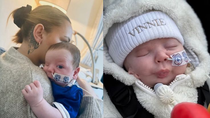 Unbelievable! Rare Congenital Condition Results In Baby Being Born With ...