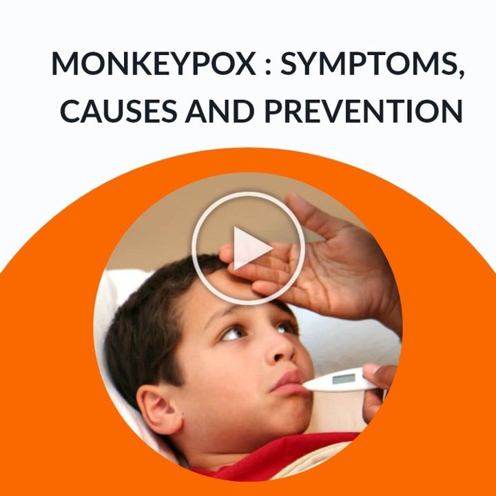 Video : Monkey Pox - Know its causes, symptoms and prevention ...