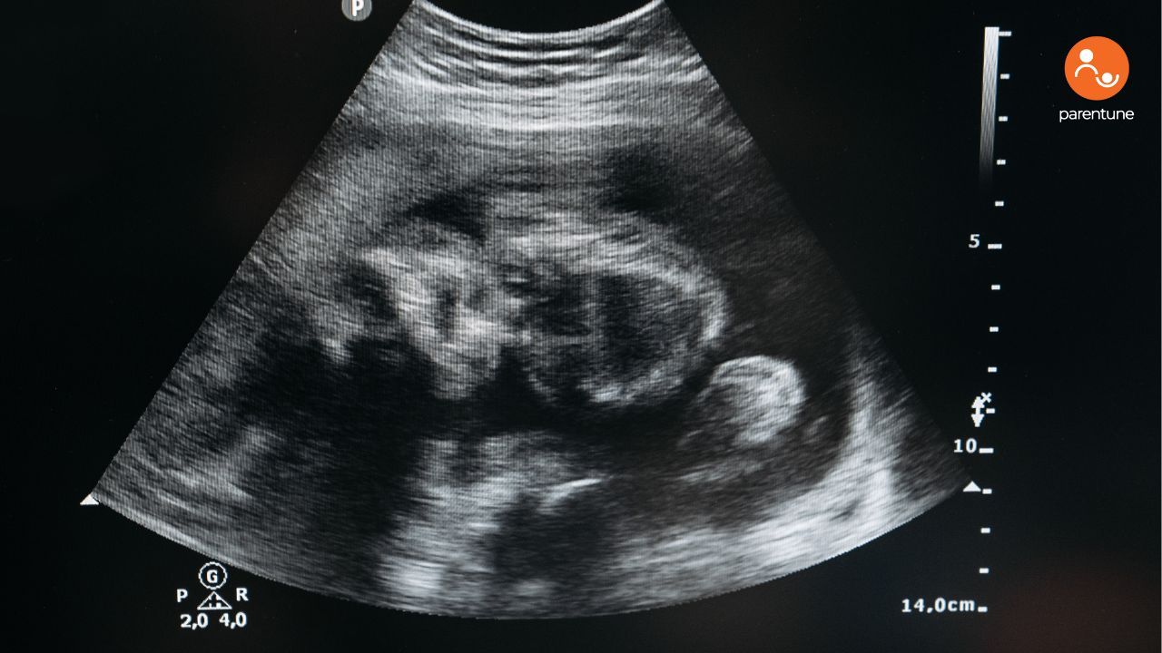 What A 6-Week Fetus Looks Like: Development, Size & Ultrasound Guide