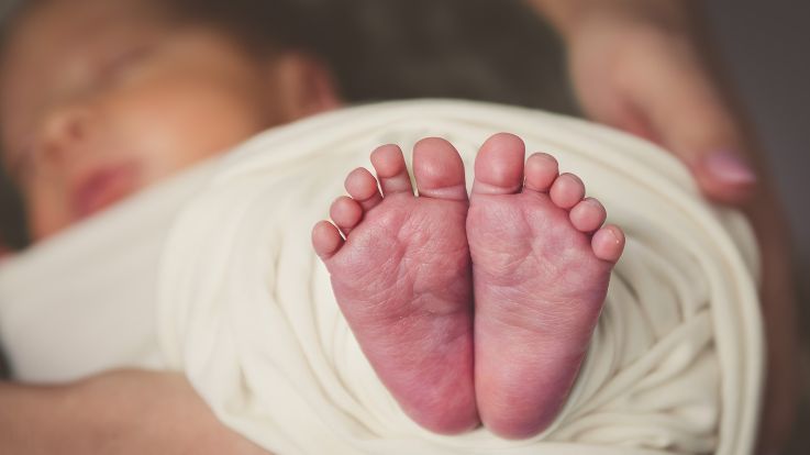 Peripheral Cyanosis In Newborn Cyanosis Wikipedia