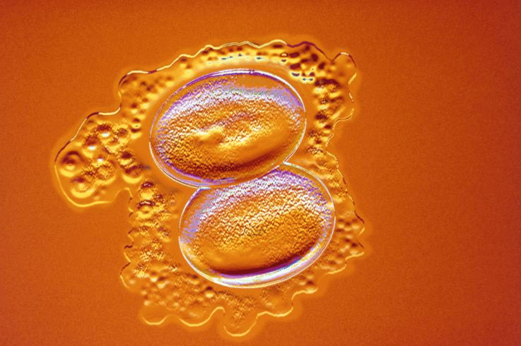 2 weeks and 3 days pregnant - Baby Fetal Progress, Ultrasound ...