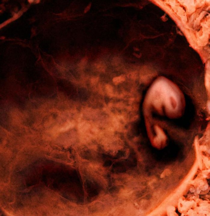 5 Weeks And 5 Days Pregnant Baby Fetal Progress Ultrasound 