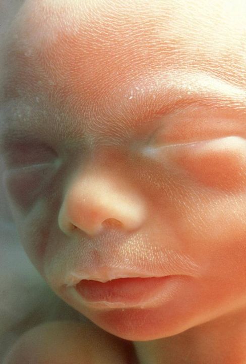 20 Weeks And 3 Days Pregnant Baby Fetal Progress Ultrasound 20 Weeks And 3 Days Pregnant Baby Fetal Progress Ultrasound